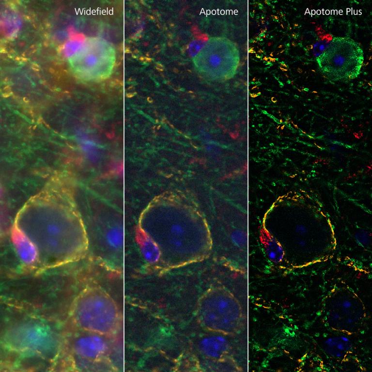 Khám phá các cấu trúc ẩn với ApoTome Plus